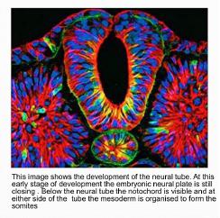 Neuralation and Somitogenesis | Flashcards