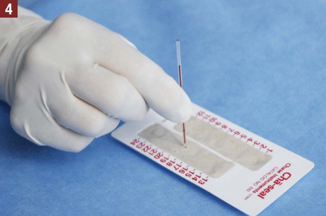 Hematocrit Determination | Flashcards