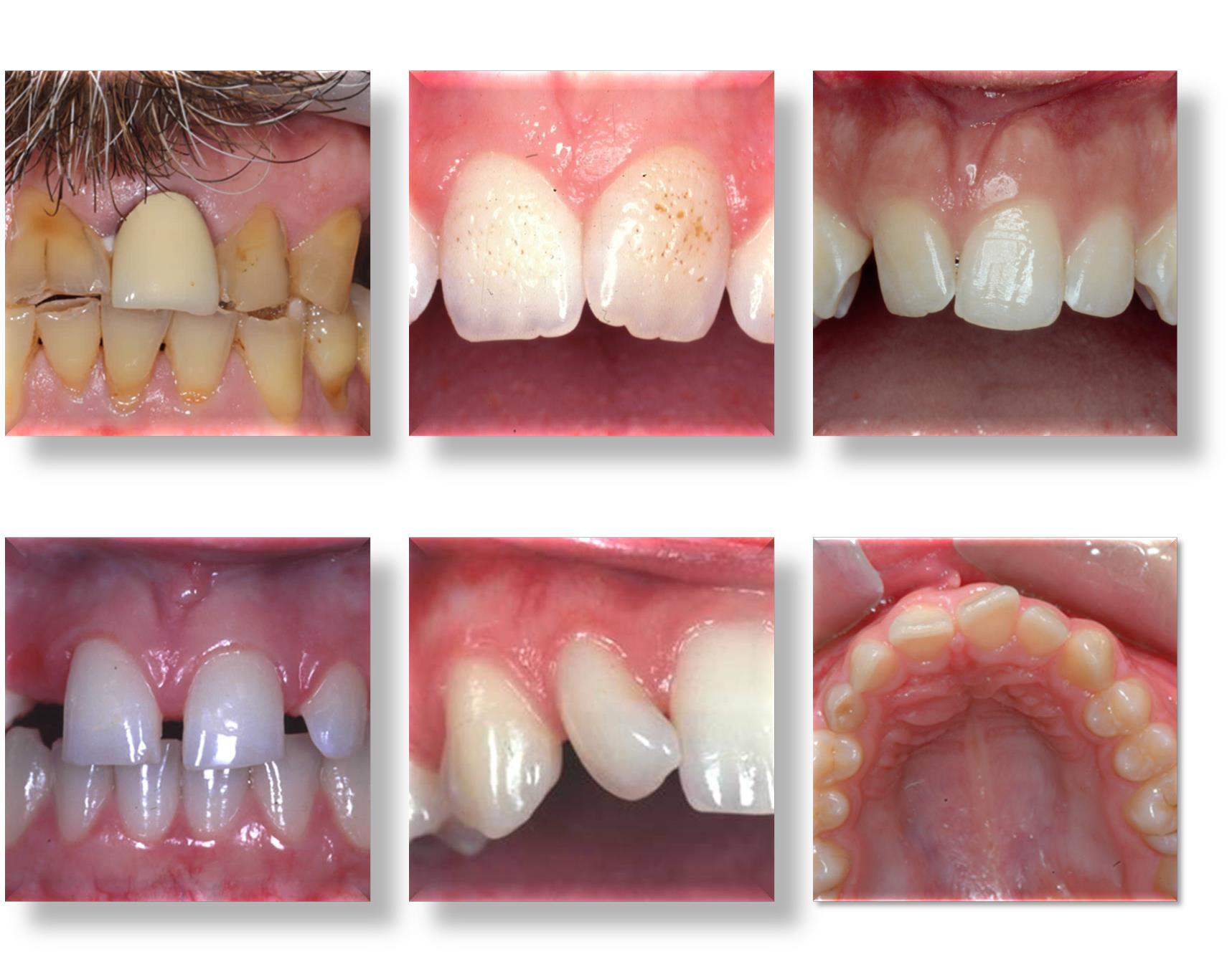 Aesthetics | Flashcards