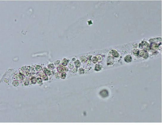 Urinalysis Microscopic | Flashcards